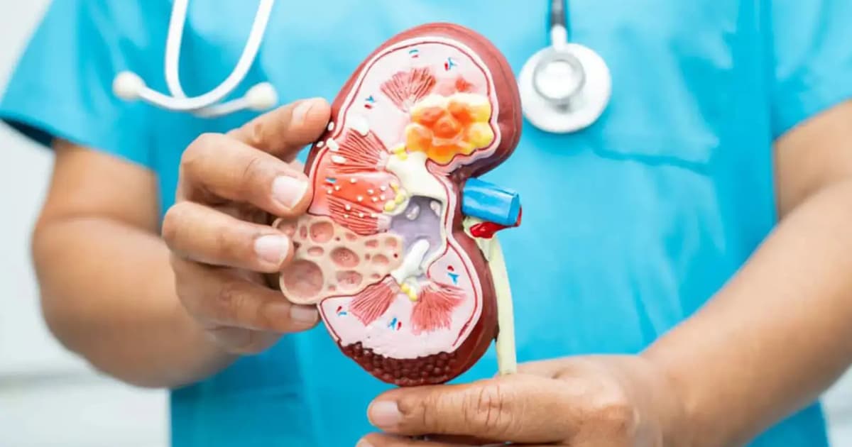 Why CKD continues to fly under the radar | FMT